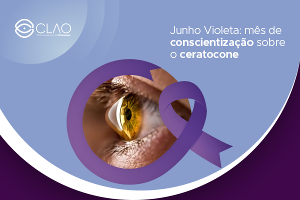Junho violeta: conscientização sobre o ceratocone - CLAO Medicina Integrada